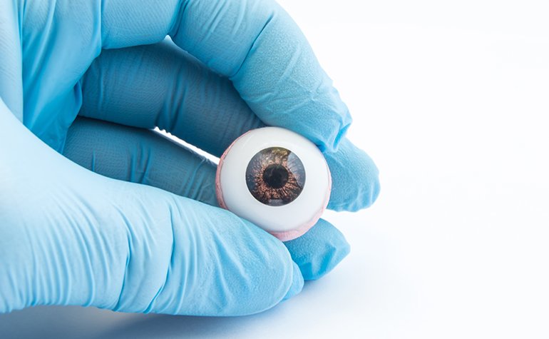 Augenprothese: Alle Infos zum Glasauge | Brille24 DE
