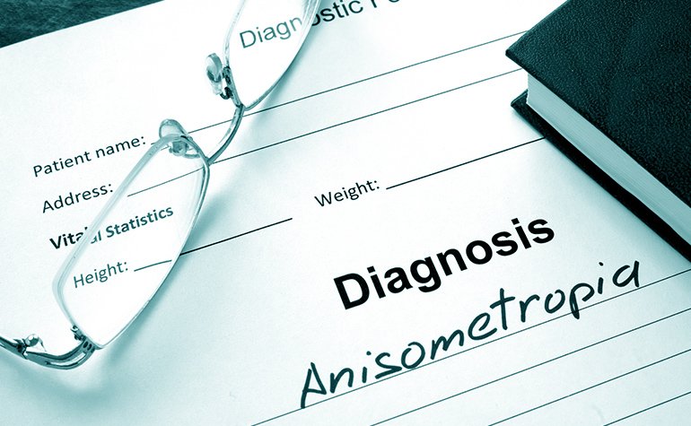 Anisometropie: Die Ungleichsichtigkeit der Augen | Brille24 DE